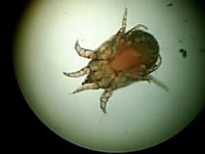Tiny White Bugs On Skin - What You Should Know About Scabies Mites ...